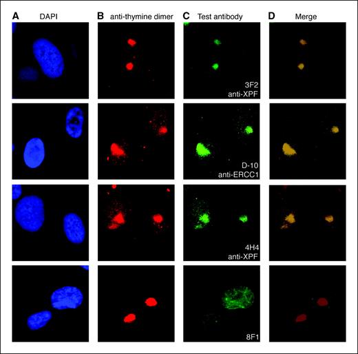 Immunodetection of DNA Repair Endonuclease ERCC1-XPF in Human Tissue | Cancer Research ...