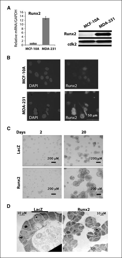 Ectopic Runx2 Expression in Mammary Epithelial Cells Disrupts Formation of Normal Acini ...