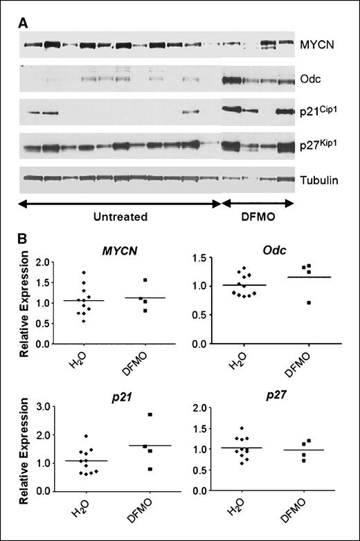 Targeting Ornithine Decarboxylase Impairs Development of MYCN-Amplified ...
