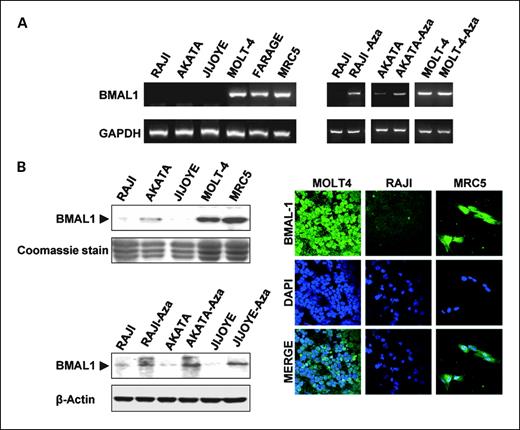 Epigenetic Inactivation of the Circadian Clock Gene BMAL1 in ...