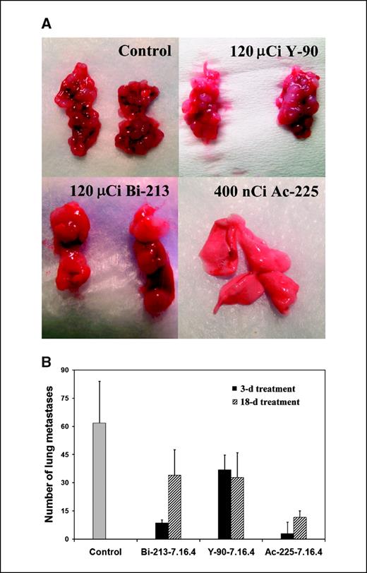 Radioimmunotherapy of Breast Cancer Metastases with α-Particle Emitter ...