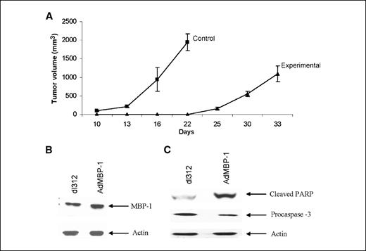 MBP-1 Inhibits Breast Cancer Growth and Metastasis in Immunocompetent ...