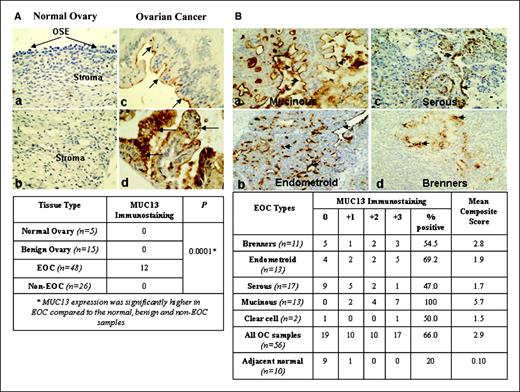 Expression and Functions of Transmembrane Mucin MUC13 in Ovarian Cancer ...