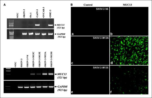 Expression and Functions of Transmembrane Mucin MUC13 in Ovarian Cancer ...