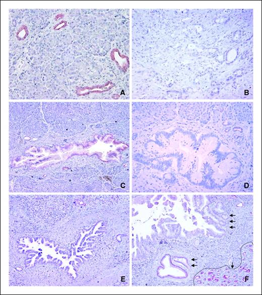 Proteasome-Mediated Degradation and Functions of Hematopoietic ...