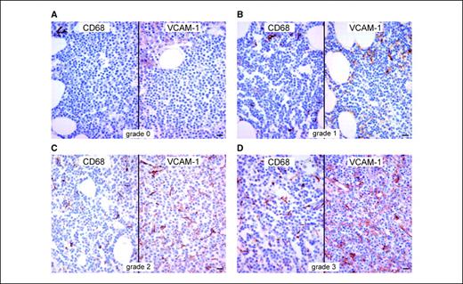 CD38/CD31, the CCL3 and CCL4 Chemokines, and CD49d/Vascular Cell ...