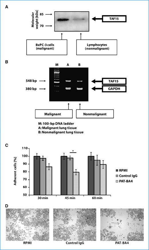 Diagnostic and Therapeutic Potential of a Human Antibody Cloned from a ...