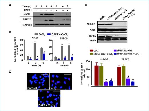 Receptor Channel TRPC6 Is a Key Mediator of Notch-Driven Glioblastoma ...
