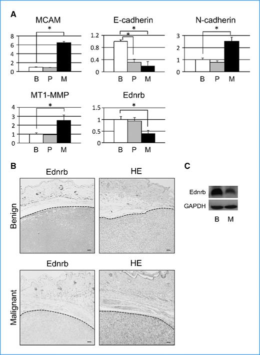 A Novel Mouse Model for De novo Melanoma | Cancer Research | American ...