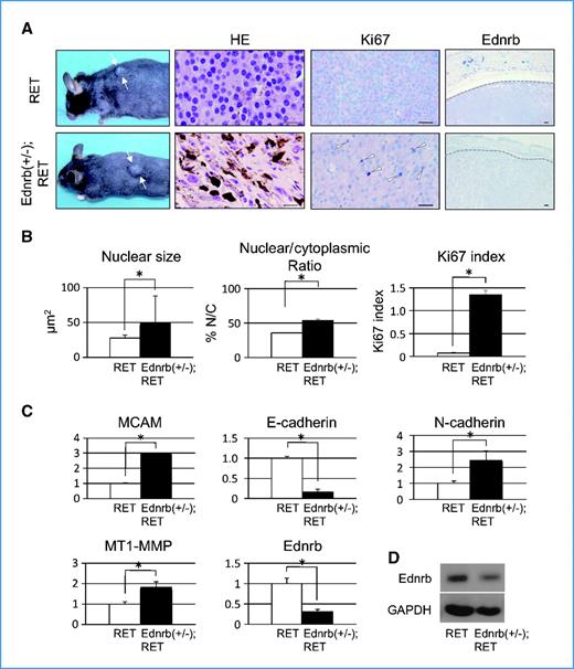 A Novel Mouse Model for De novo Melanoma | Cancer Research | American ...
