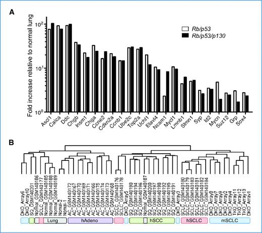 Loss of p130 Accelerates Tumor Development in a Mouse Model for Human ...