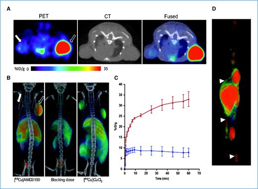 Molecular Imaging of CXCR4 Receptor Expression in Human Cancer ...