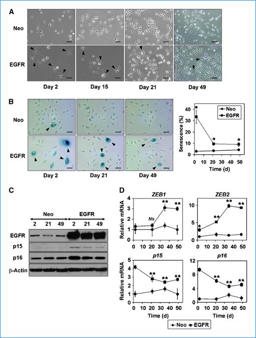 Epidermal Growth Factor Receptor and Mutant p53 Expand an Esophageal ...
