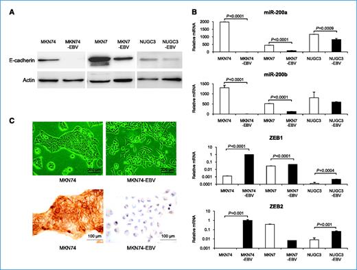Downregulation of MicroRNA-200 in EBV-Associated Gastric Carcinoma ...