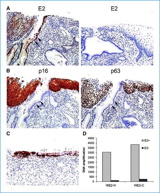 HPV16 E2 Is an Immediate Early Marker of Viral Infection, Preceding E7 ...
