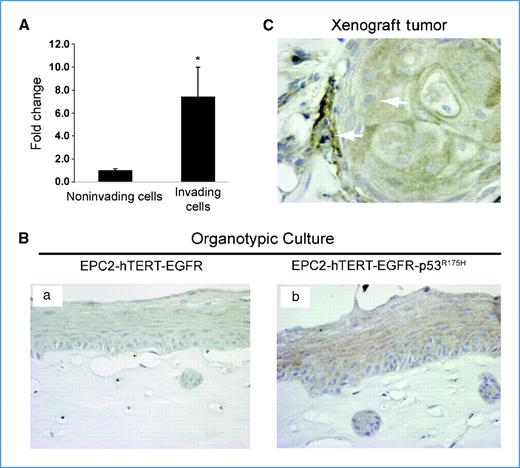 Periostin, a Cell Adhesion Molecule, Facilitates Invasion in the Tumor ...