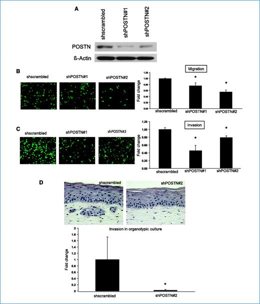 Periostin, a Cell Adhesion Molecule, Facilitates Invasion in the Tumor ...