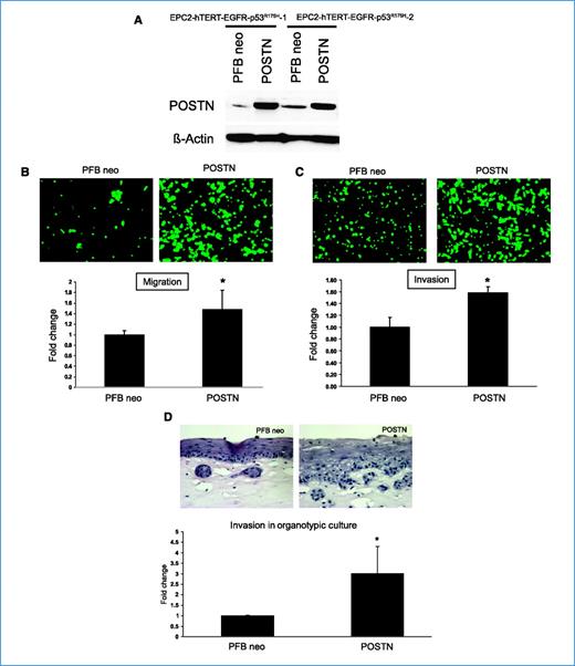 Periostin, a Cell Adhesion Molecule, Facilitates Invasion in the Tumor ...