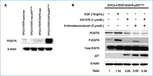 Periostin, a Cell Adhesion Molecule, Facilitates Invasion in the Tumor ...