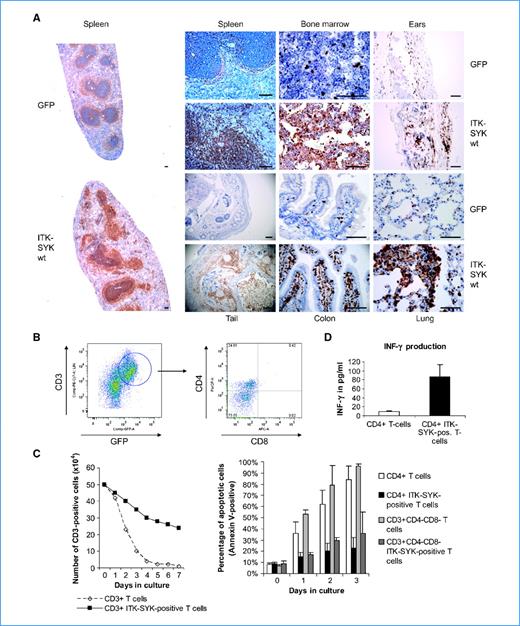 The ITK-SYK Fusion Oncogene Induces a T-Cell Lymphoproliferative ...
