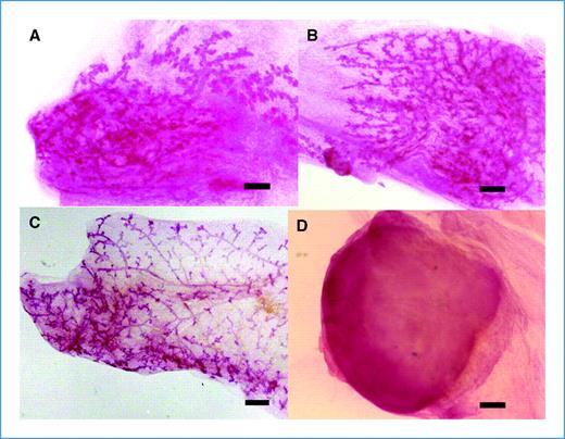 Reprogramming Human Cancer Cells in the Mouse Mammary Gland | Cancer ...
