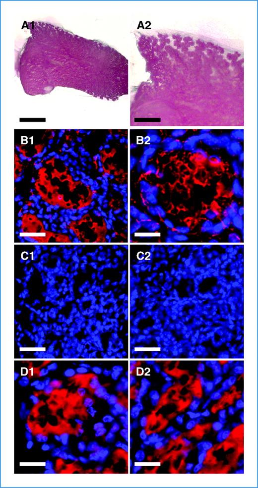 Reprogramming Human Cancer Cells in the Mouse Mammary Gland | Cancer ...