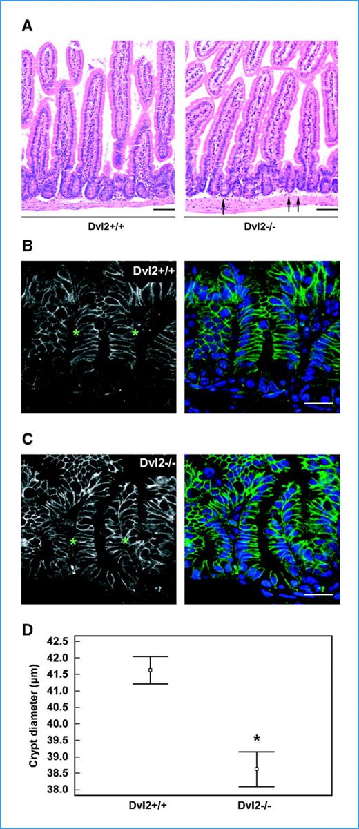 Dvl2 Promotes Intestinal Length and Neoplasia in the ApcMin Mouse Model ...
