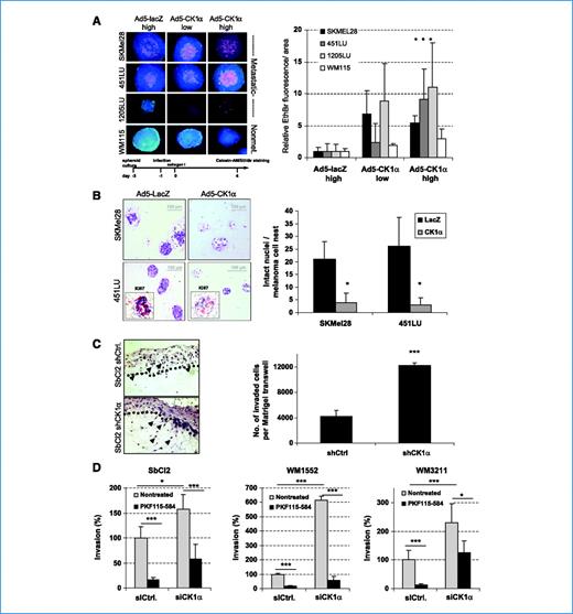Suppression of Casein Kinase 1α in Melanoma Cells Induces a Switch in β ...