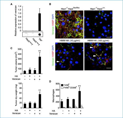 Hyaluronan Deficiency in Tumor Stroma Impairs Macrophage Trafficking ...