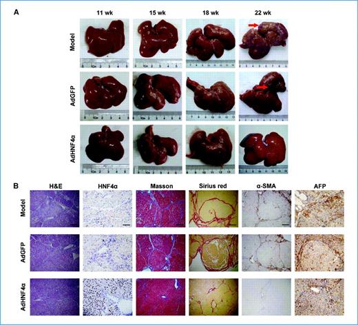 Hepatocyte Nuclear Factor 4α Suppresses the Development of ...
