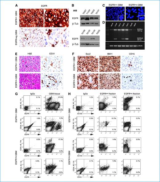 Epidermal Growth Factor Receptor Expression Identifies Functionally and ...