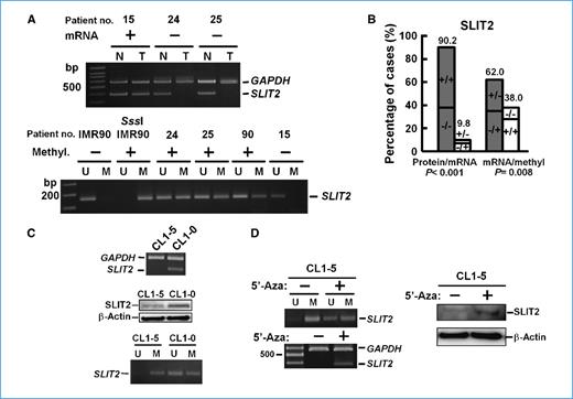 SLIT2 Attenuation during Lung Cancer Progression Deregulates β-Catenin ...