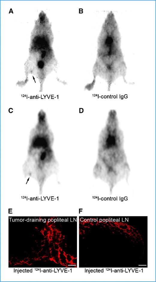 In vivo Imaging of Inflammation- and Tumor-Induced Lymph Node ...