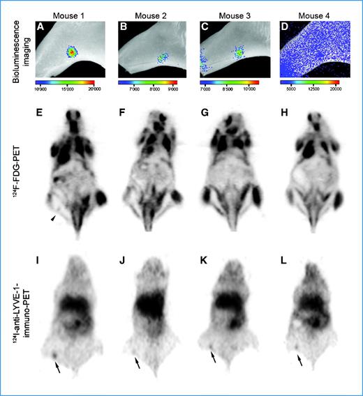 In vivo Imaging of Inflammation- and Tumor-Induced Lymph Node ...