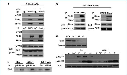 mTOR Complex Component Rictor Interacts with PKCζ and Regulates Cancer ...