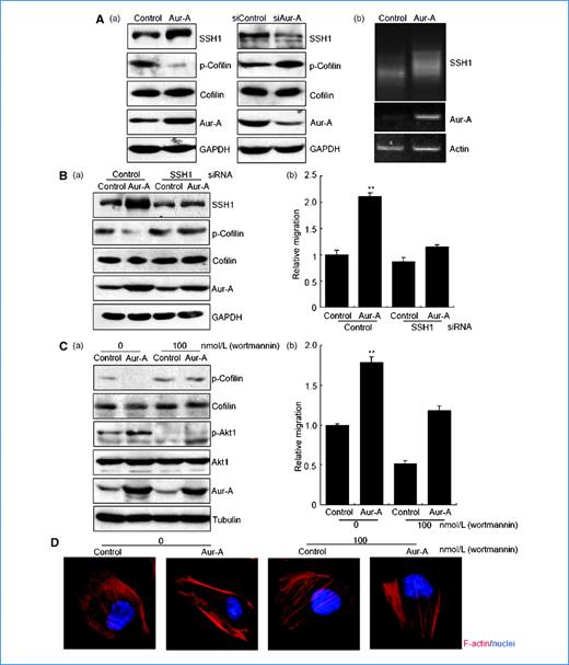 The Mitotic Kinase Aurora-A Induces Mammary Cell Migration and Breast ...