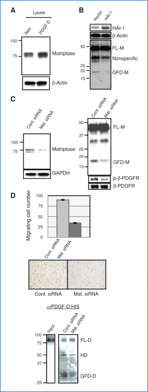 A Novel Signaling Axis of Matriptase/PDGF-D/β-PDGFR in Human Prostate ...