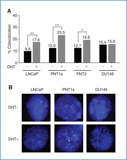 Androgen-Induced TMPRSS2:ERG Fusion in Nonmalignant Prostate Epithelial ...