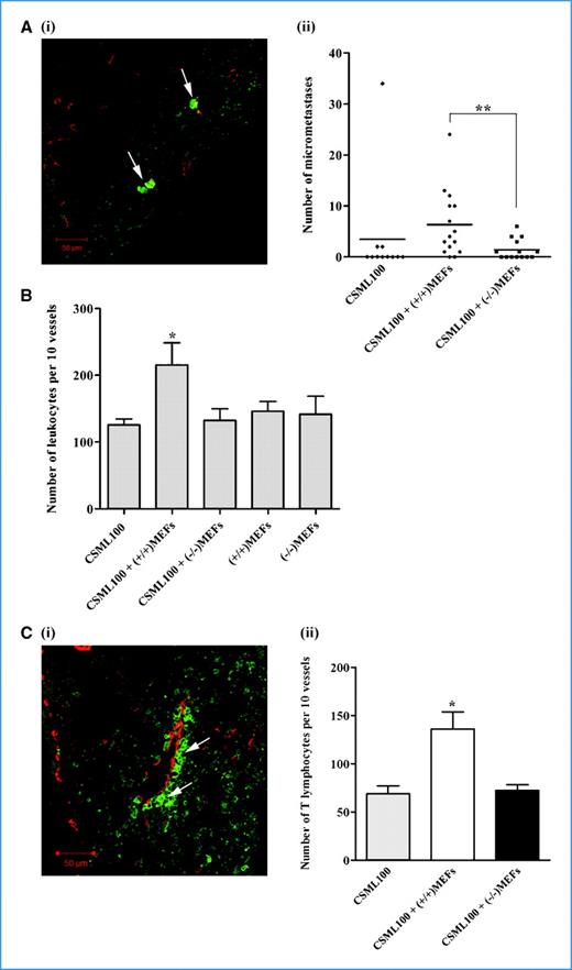 Lung Metastasis Fails in MMTV-PyMT Oncomice Lacking S100A4 Due to a T ...