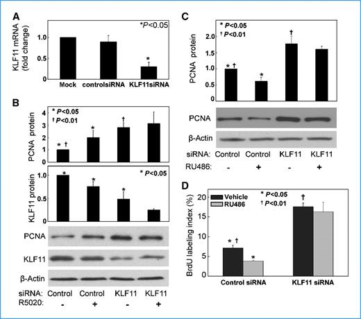 Transcription Factor KLF11 Integrates Progesterone Receptor Signaling ...