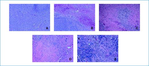 Irreversible Electroporation Therapy in the Liver: Longitudinal ...