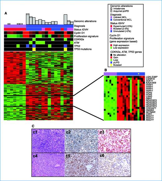 Genomic and Gene Expression Profiling Defines Indolent Forms of Mantle ...