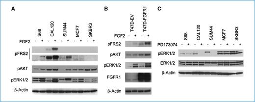 FGFR1 Amplification Drives Endocrine Therapy Resistance and Is a ...