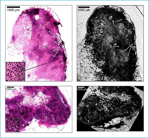 Imaging of Human Lymph Nodes Using Optical Coherence Tomography ...