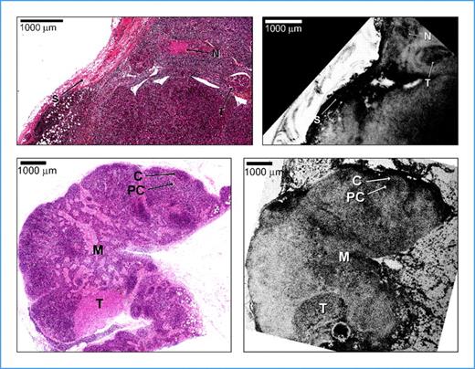 Imaging of Human Lymph Nodes Using Optical Coherence Tomography ...