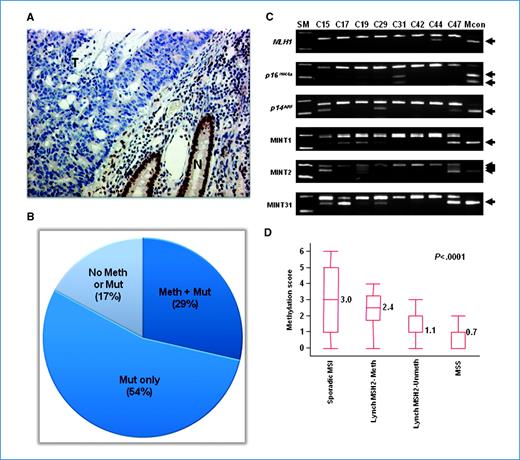 Somatic Hypermethylation of MSH2 Is a Frequent Event in Lynch Syndrome ...