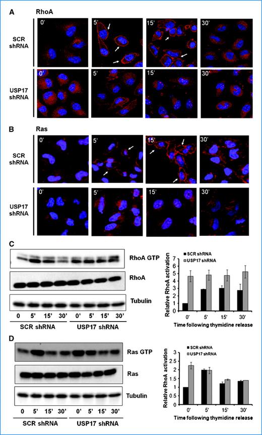 The Deubiquitinating Enzyme USP17 Is Highly Expressed in Tumor Biopsies ...