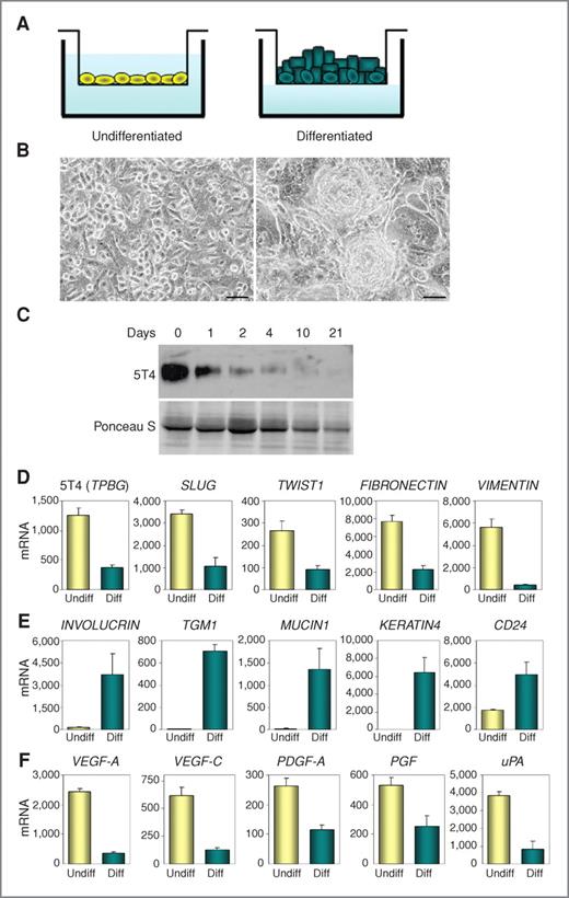 Delineation of a Cellular Hierarchy in Lung Cancer Reveals an Oncofetal ...