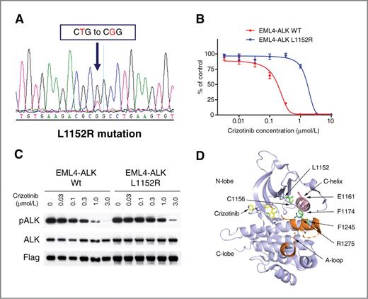 A Novel ALK Secondary Mutation and EGFR Signaling Cause Resistance to ...