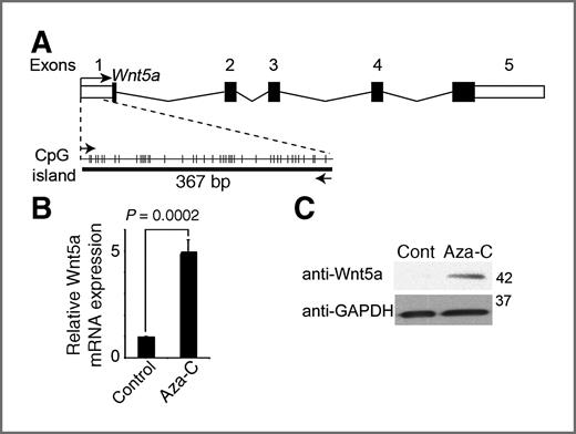 Wnt5a Suppresses Epithelial Ovarian Cancer by Promoting Cellular Senescence | Cancer Research ...
